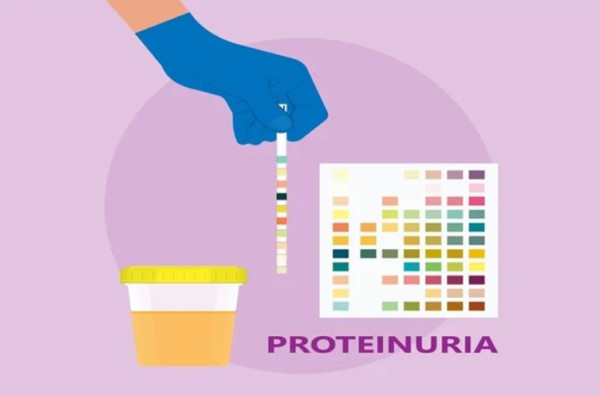 Proteinuria: What is it and How I Treat | BCNephro