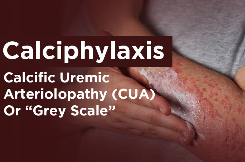 Dermatologic Conditions in ESRD | BCNephro